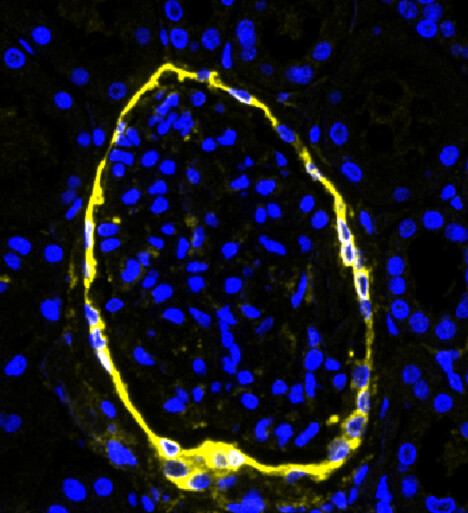 Glomerulus segmentation - Image Analysis - Image.sc Forum