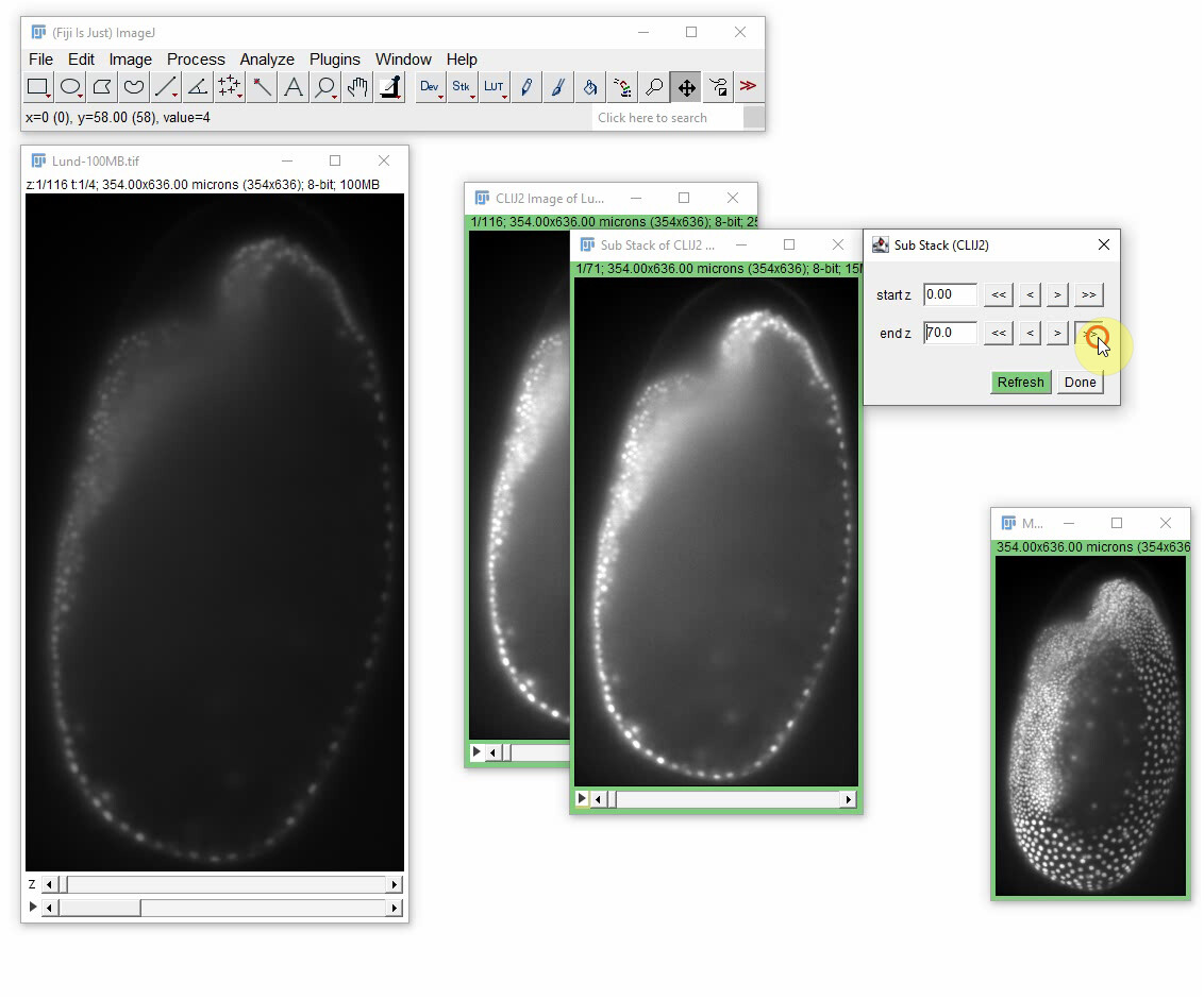 Z Projection preview tool - Image Analysis - Image.sc Forum