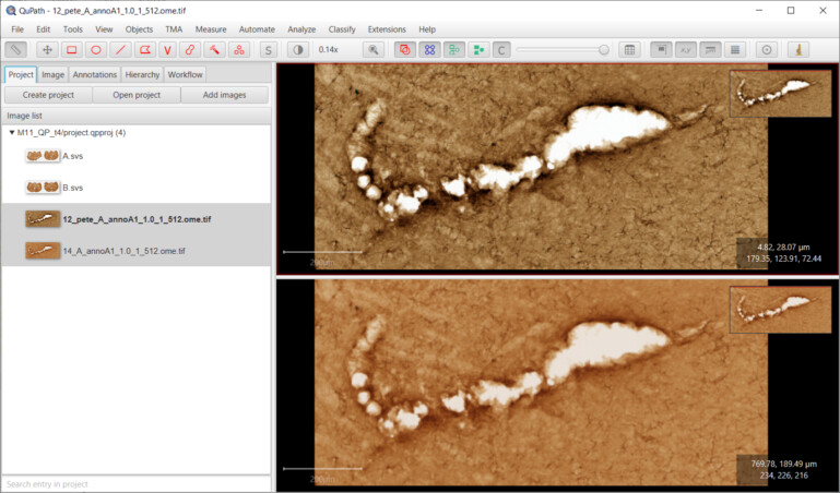 ᴗ• Qupath Scripting 1 Using Clupath To Save Smoothed Image Regions Usage And Issues