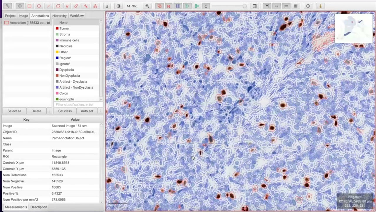 Leica las X soft ware and camera - Image Analysis - Image.sc Forum