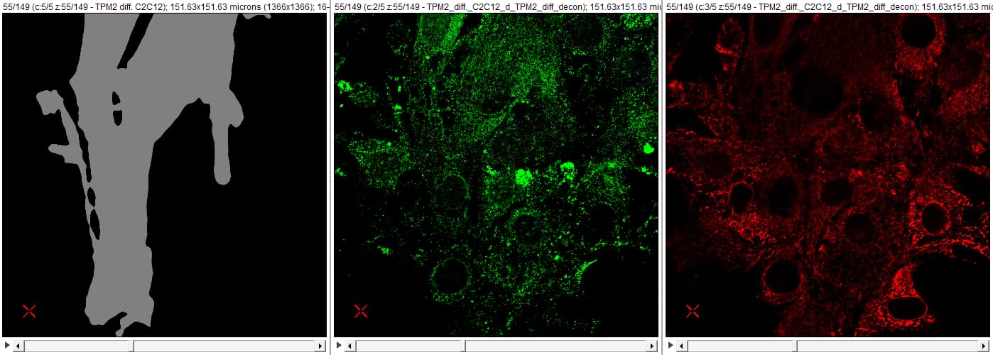 In search of a solution for 3D Intensities’ overlap-based quantifiers with external mask - Image ...