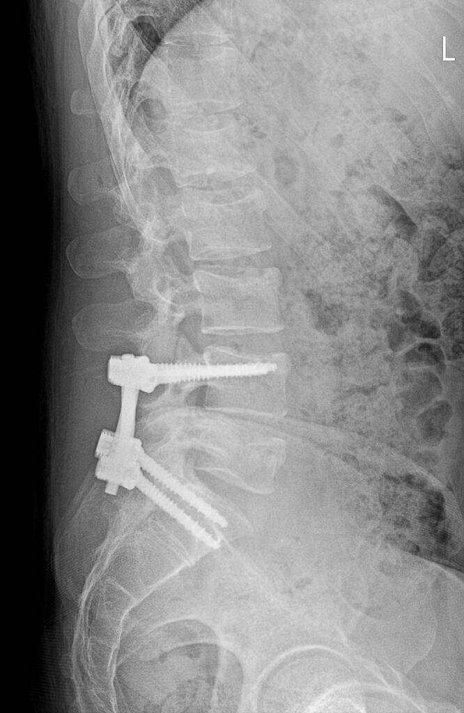 Swapify: Cross-Chain Token Swapping dApp on Astar Network - dApp Staking Proposal - Astar ...