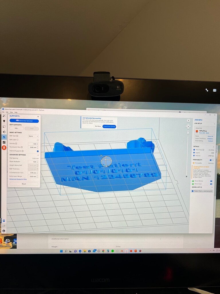 Preform fills in first layers on model that aren't in the preview - Support & Troubleshooting ...